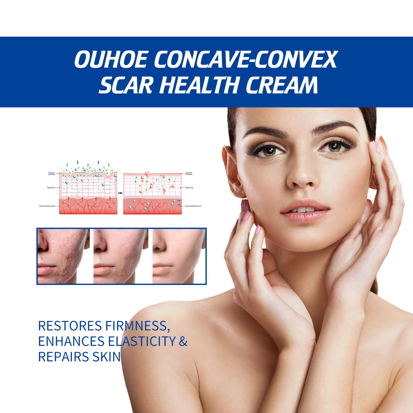 Scar Removal Cream - Guangzhou Skin Care manufacturer in China | 15 ...