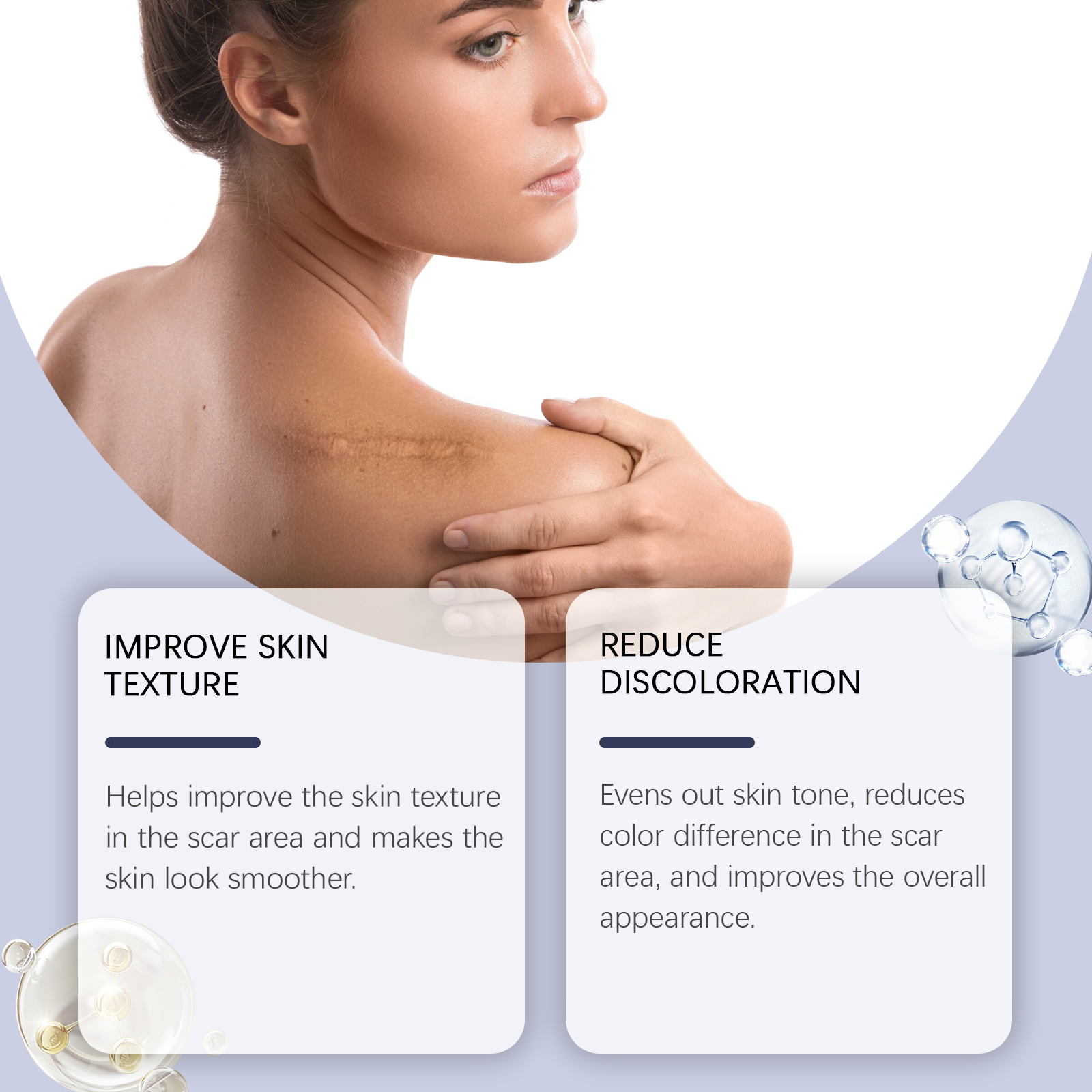 Body Scar Relief Cream - Leading Cosmetics Manufacturer in Guangzhou ...