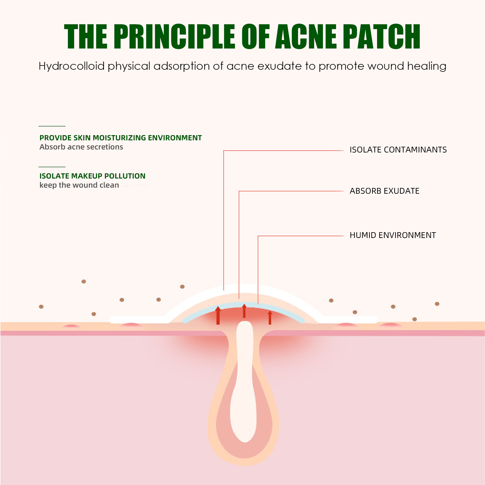 Hydrocolloid Acne Patch - Guangzhou Skin Care manufacturer in China ...